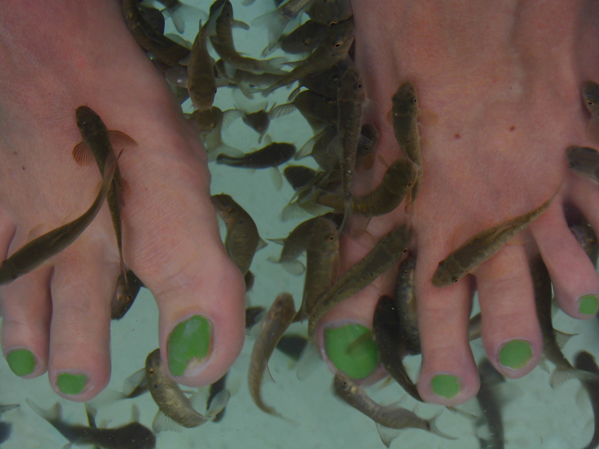 "Medical fish" eine neue Erfahrung für die Gesundheit . . . - Burgdorf